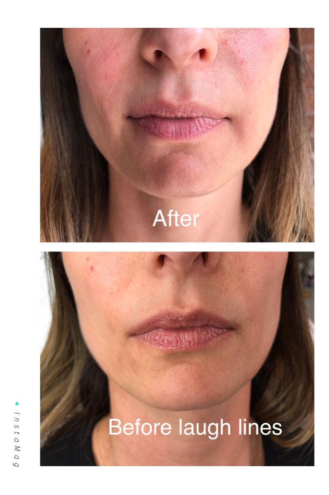 DANIELA BEAUTY NURSE - Updated December 2025 - 12 Photos - Newmarket ...