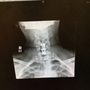 SCOTT I. LEE, MD - Updated May 2026 - 49 Reviews - 1500 S Central Ave ...