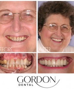 GORDON DENTAL IMPLANTS AND COSMETICS - Updated June 2025 - 33 Photos ...