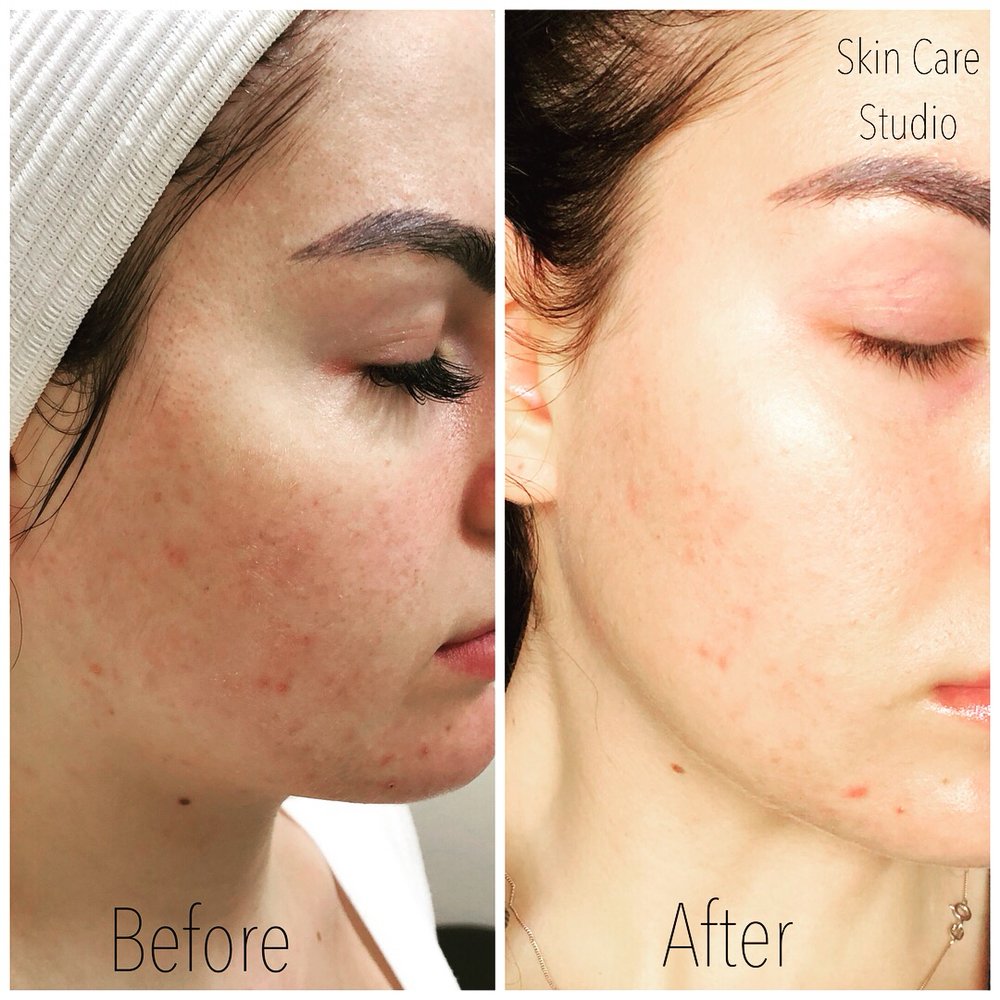 SKIN CARE STUDIO - Updated July 2025 - 15 Photos & 35 Reviews - 22845 ...