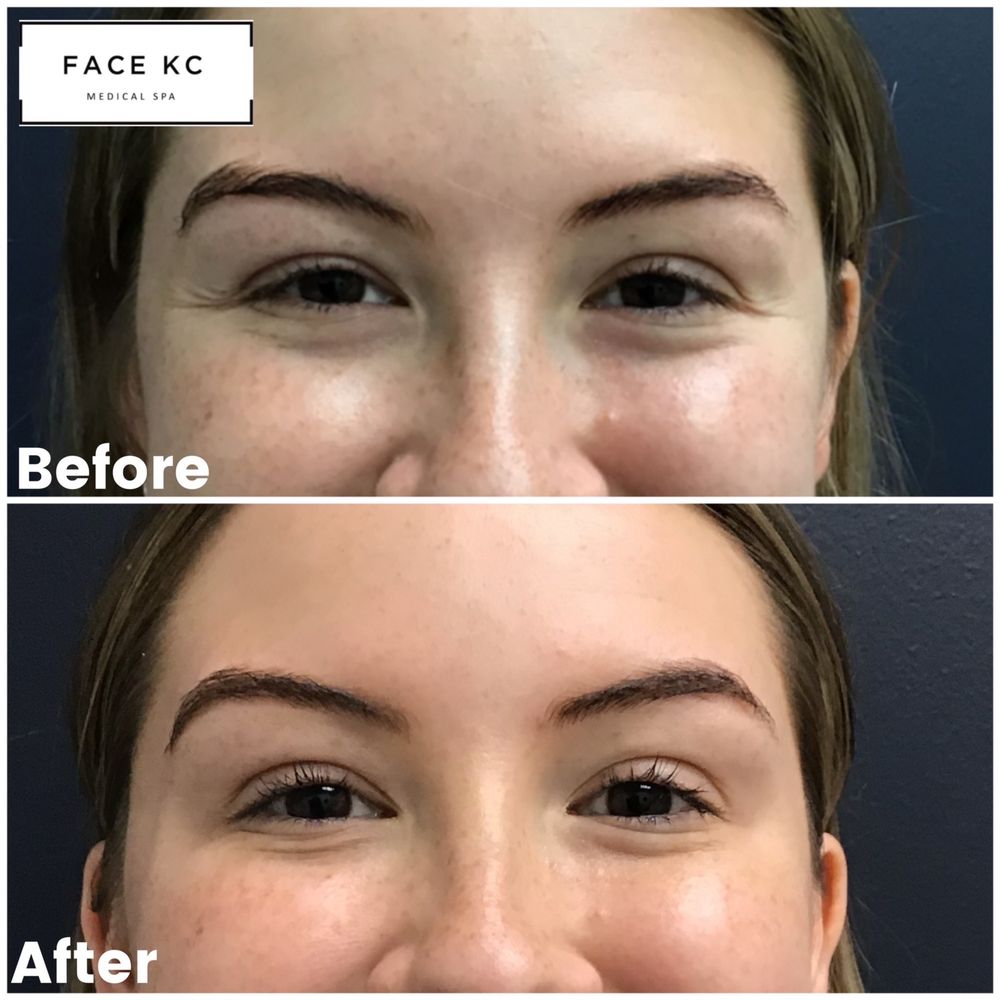 FACE KC MEDICAL SPA - 26 Photos - 8006 N Brighton Ave, Kansas City ...