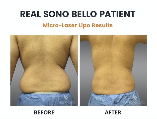 SONO BELLO - Updated October 2025 - 19 Photos & 35 Reviews - 7455 ...