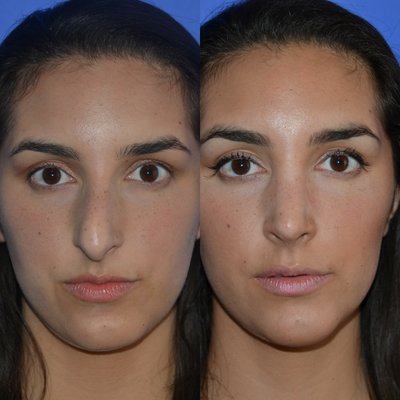 ASHKAN GHAVAMI, MD - Updated January 2026 - 240 Photos & 165 Reviews ...