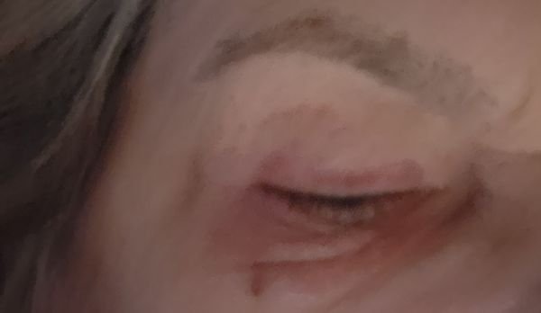 PHILLIPS EYE CENTER - Updated December 2025 - 37 Photos & 66 Reviews ...