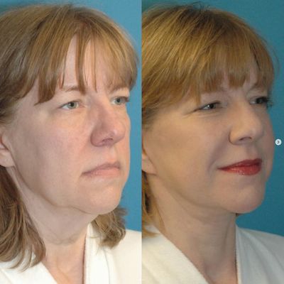 SOUND PLASTIC SURGERY - Updated October 2025 - 30 Photos & 53 Reviews ...