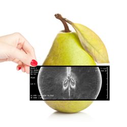 MRI LINCOLN IMAGING CENTER - 18 Photos & 24 Reviews - Diagnostic ...