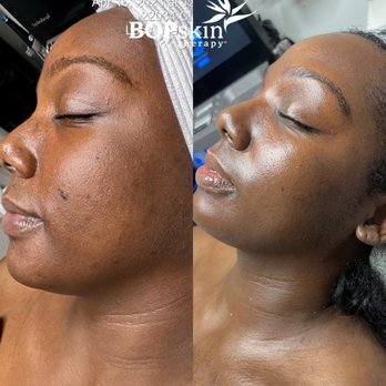 Microcurrent facial near me store