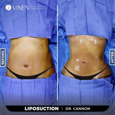 VIXEN PLASTIC SURGERY - Updated December 2025 - 53 Photos & 71 Reviews ...