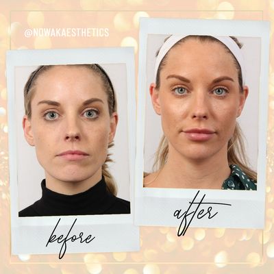 NOWAK AESTHETICS - Updated March 2026 - 188 Photos & 168 Reviews - 2440 ...