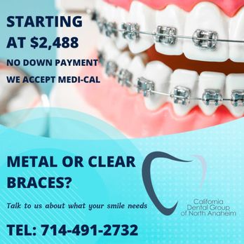 CALIFORNIA DENTAL GROUP OF NORTH ANAHEIM Updated January 2025 28 Photos 40 Reviews 1221 N Euclid St Anaheim California General Dentistry Phone Number Yelp