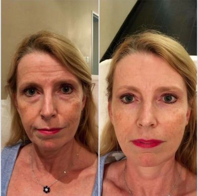 LILLY BEAUTY MEDICAL SPA - Updated November 2025 - 36 Photos & 85 ...