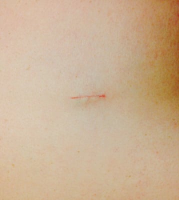 JEFFREY S ROH, MD - Updated January 2026 - 20 Photos & 21 Reviews - 500 ...