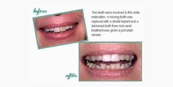 DAVID A RICE, DDS - Updated October 2025 - 38 Photos & 24 Reviews ...