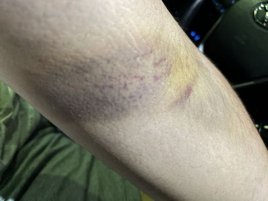 BIOLIFE PLASMA SERVICES - Updated December 2025 - 31 Photos & 63 ...