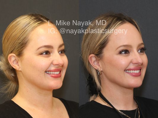 NAYAK PLASTIC SURGERY - Updated March 2025 - 266 Photos & 33 Reviews ...