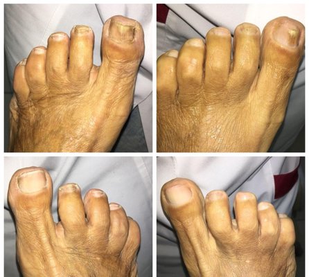 MEDI PEDI NYC - 53 Photos & 96 Reviews - Nail Salons - 20 Park Ave, New ...