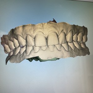 CAPITAL ENT & SINUS CENTER - Updated April 2025 - 51 Photos & 198 ...