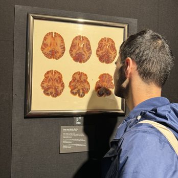 BODY WORLDS EXHIBIT - Updated January 2026 - 71 Photos - 343 Newbury St ...