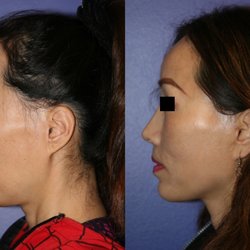 EVAN RANSOM, MD - 101 Photos & 164 Reviews - Cosmetic Surgeons - 450 ...