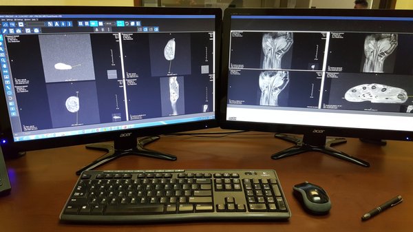 PRECISE IMAGING - Updated March 2025 - 27 Photos & 70 Reviews - 6710 ...