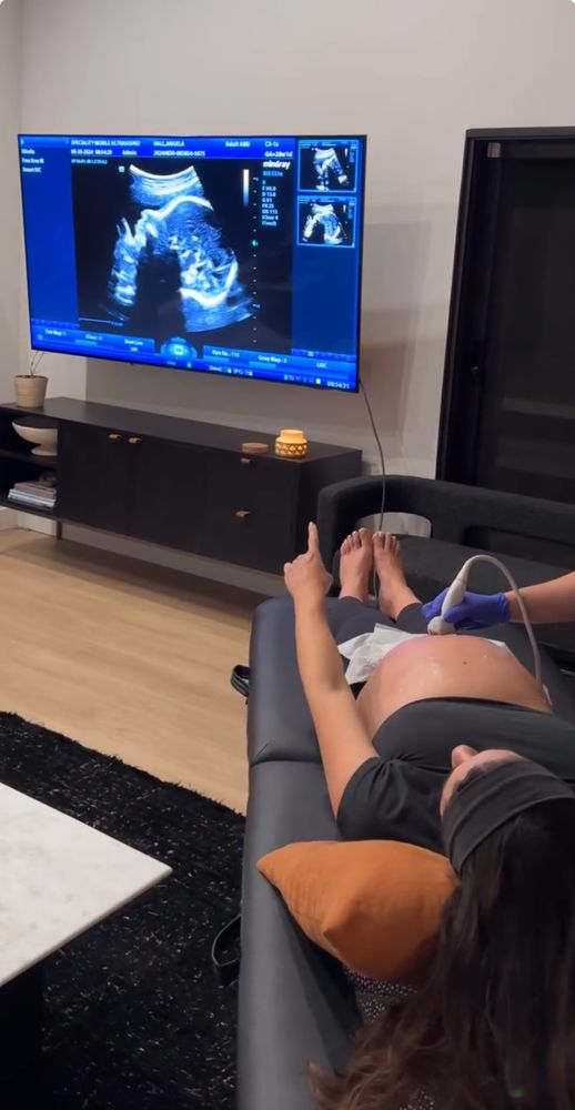 SPECIALTY MOBILE ULTRASOUND - Updated December 2025 - 10 Photos - San ...