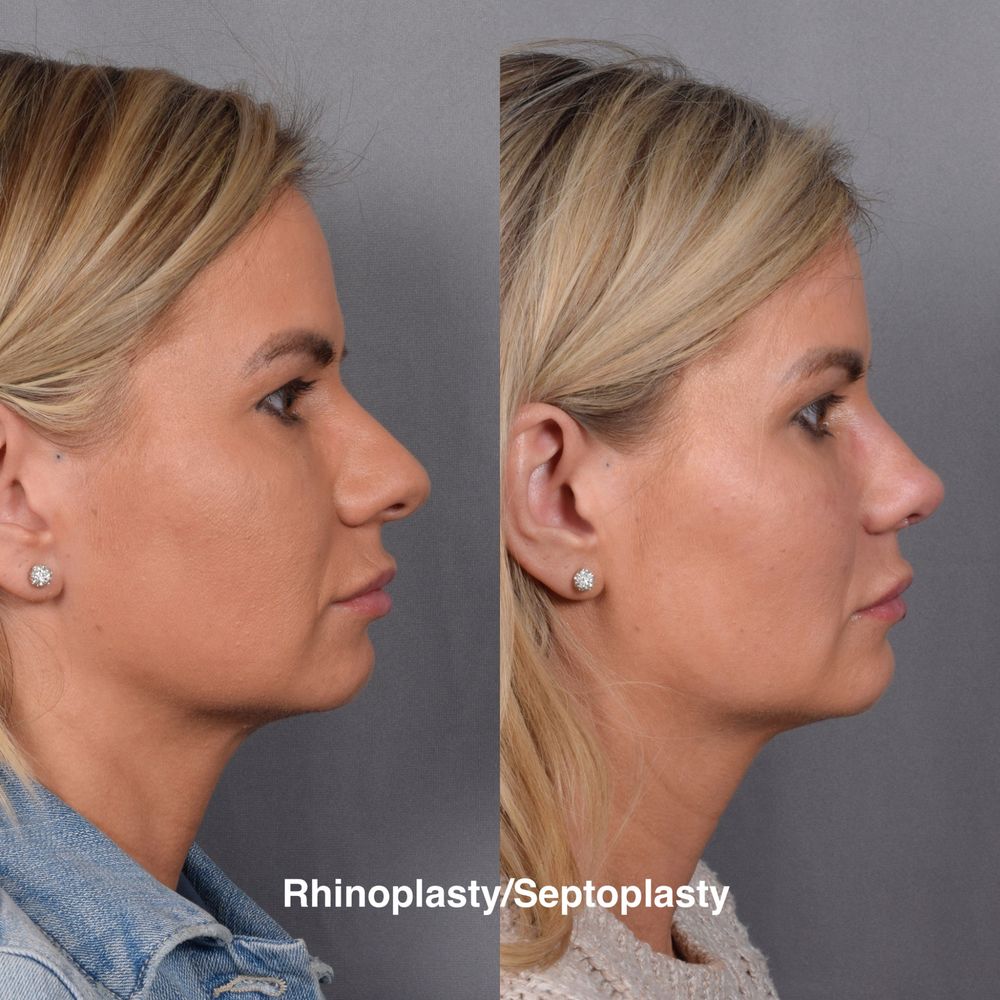 VEGAS FACIAL PLASTICS - MEHDI SINA MD, MBA - Updated December 2025 ...