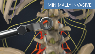 ERIK C SPAYDE, MD - Updated December 2025 - 18 Photos & 45 Reviews ...