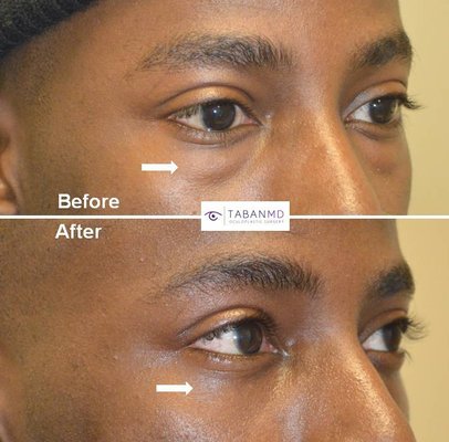 MEHRYAR RAY TABAN MD - OCULOPLASTIC SURGEON - Updated December 2025 ...