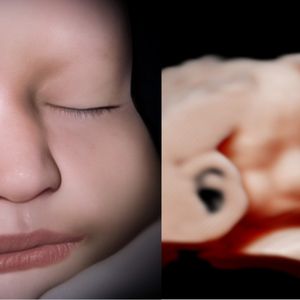 VALLEY REGIONAL IMAGING - Updated February 2025 - 3186 Village Dr ...