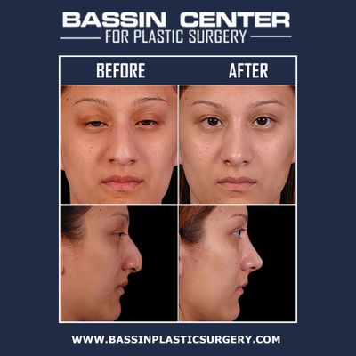 THE BASSIN CENTER FOR PLASTIC SURGERY - Updated January 2026 - 25 ...