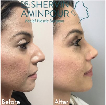 SHERVIN AMINPOUR, MD - Updated January 2026 - 12 Photos & 43 Reviews ...