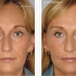 TAL DAGAN, MD, FACS - 22 Photos & 73 Reviews - 420 Madison Ave, New ...