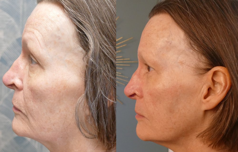 BODY FRAME SPA - Updated May 2026 - 32 Photos & 12 Reviews - 8216 A Old ...