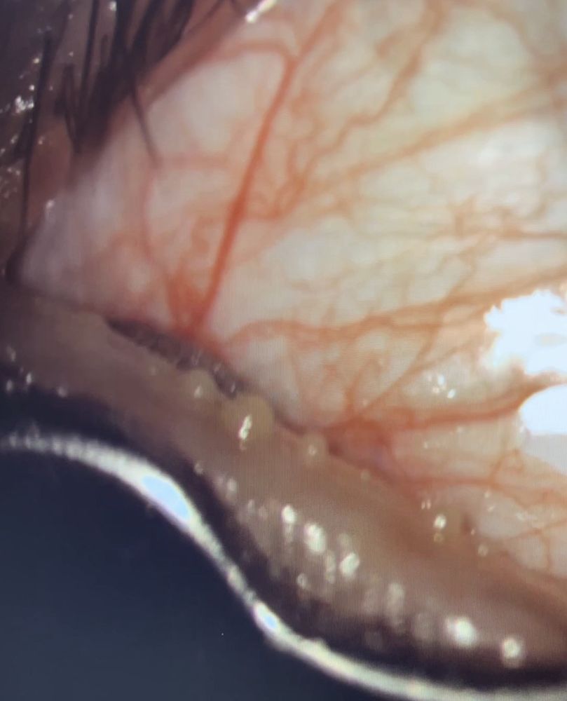 EYE CONNECTION OPTOMETRY - Updated October 2025 - 12 Reviews - 9516 ...