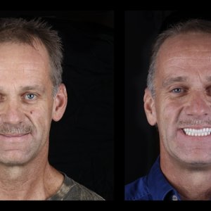 GRAYSTONE EYE - Updated December 2025 - 48 Boone Trail, North ...