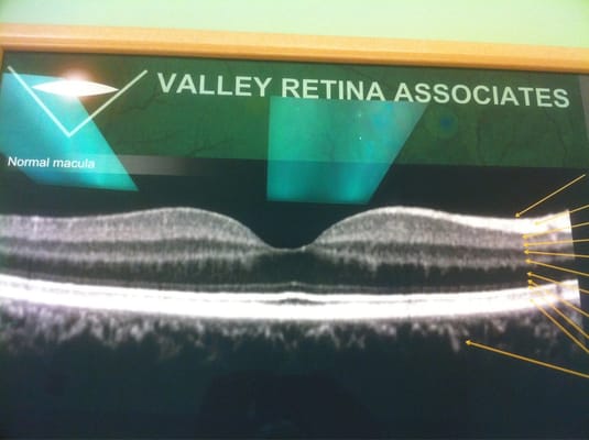 THE RETINA PARTNERS - Updated June 2026 - 34 Reviews - 23929 McBean ...
