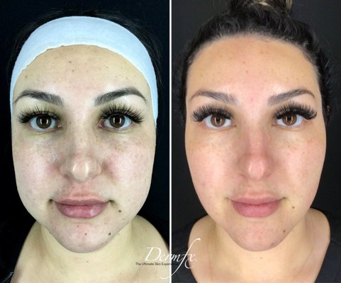 DERMFX - Updated December 2025 - 173 Photos & 288 Reviews - 3443 E ...