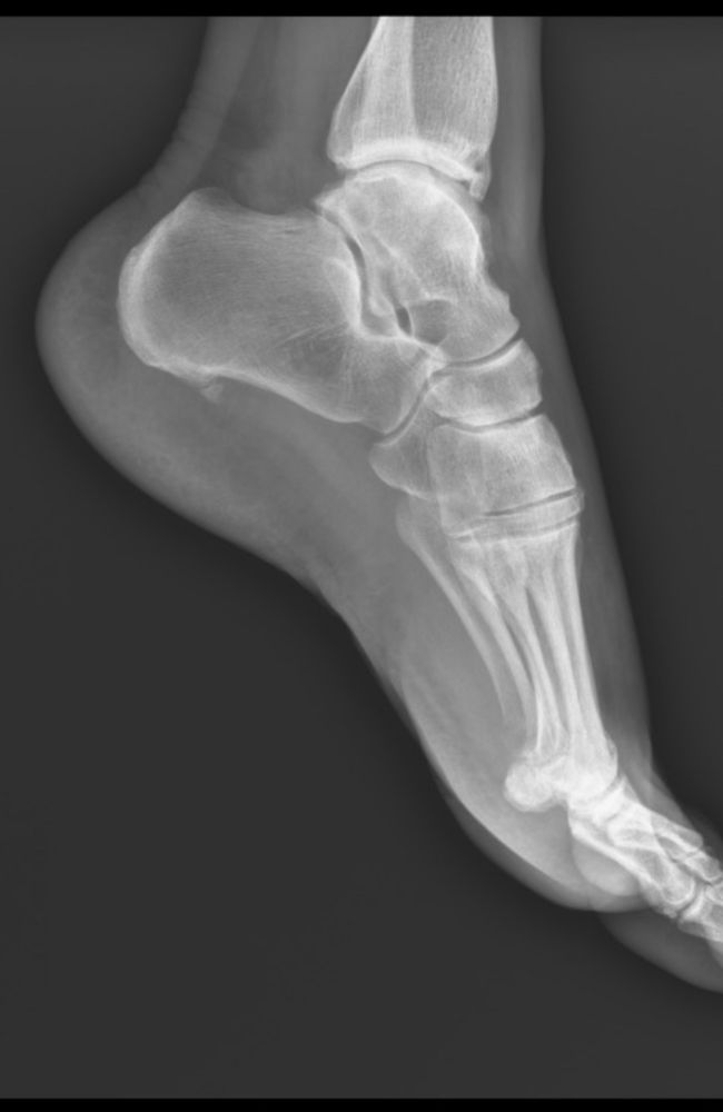 HANGER PROSTHETICS & ORTHOTICS - Updated December 2025 - 10 Reviews ...