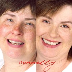 THOMAS CONNELLY, DDS - 44 Photos & 22 Reviews - 450 N Roxbury Dr ...