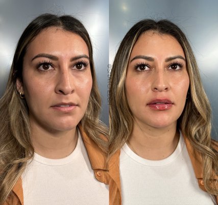 SNATCHED BEVERLY HILLS - Updated December 2025 - 114 Photos & 72 ...