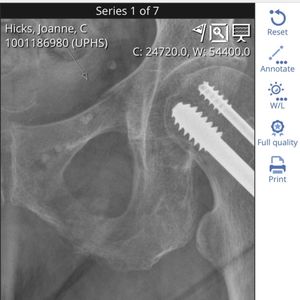 OPEN MRI OF BALA CYNWYD - Updated January 2025 - 12 Reviews - 301 E ...