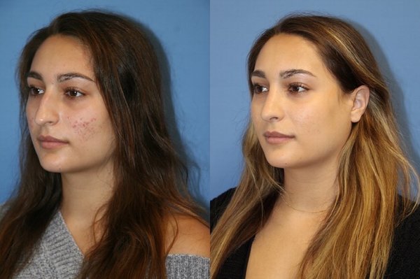 EVAN RANSOM, MD - Updated December 2025 - 126 Photos & 241 Reviews ...