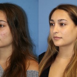 EVAN RANSOM, MD - 123 Photos & 171 Reviews - Cosmetic Surgeons - 450 ...