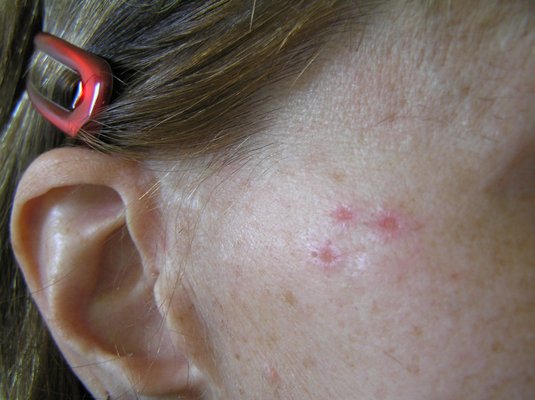 RAFI ISRAEL, MD - Updated December 2025 - 14 Reviews - 9025 Wilshire ...