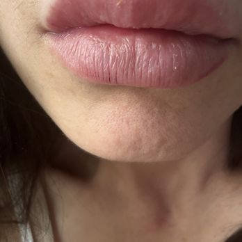 SYNERCHI MEDICAL SPA - Updated June 2025 - 96 Photos & 352 Reviews ...