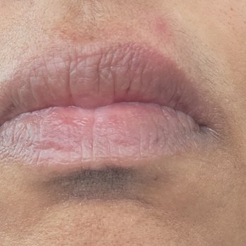 GEORGIA SKIN SPECIALISTS - Updated October 2025 - 18 Photos & 64 ...