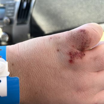 SHANDS EMERGENCY ROOM - Updated October 2025 - 43 Reviews - 1515 SW ...