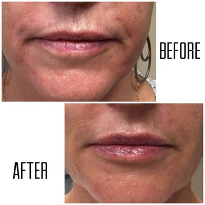 JOHN J. COREY, MD - AESTHETIC PLASTIC SURGERY - Updated December 2025 ...