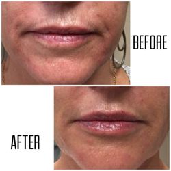 JOHN J. COREY, MD - AESTHETIC PLASTIC SURGERY - 142 Photos & 45 Reviews ...