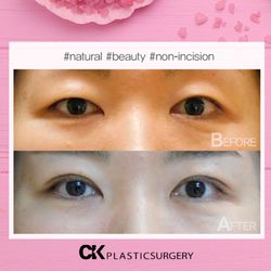 CK PLASTIC SURGERY - 177 Photos & 74 Reviews - Cosmetic Surgeons - 2970 ...